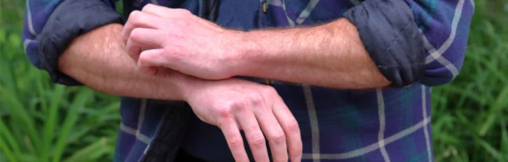 Repousser les puces sur l’homme : les solutions - Mesnuisibles